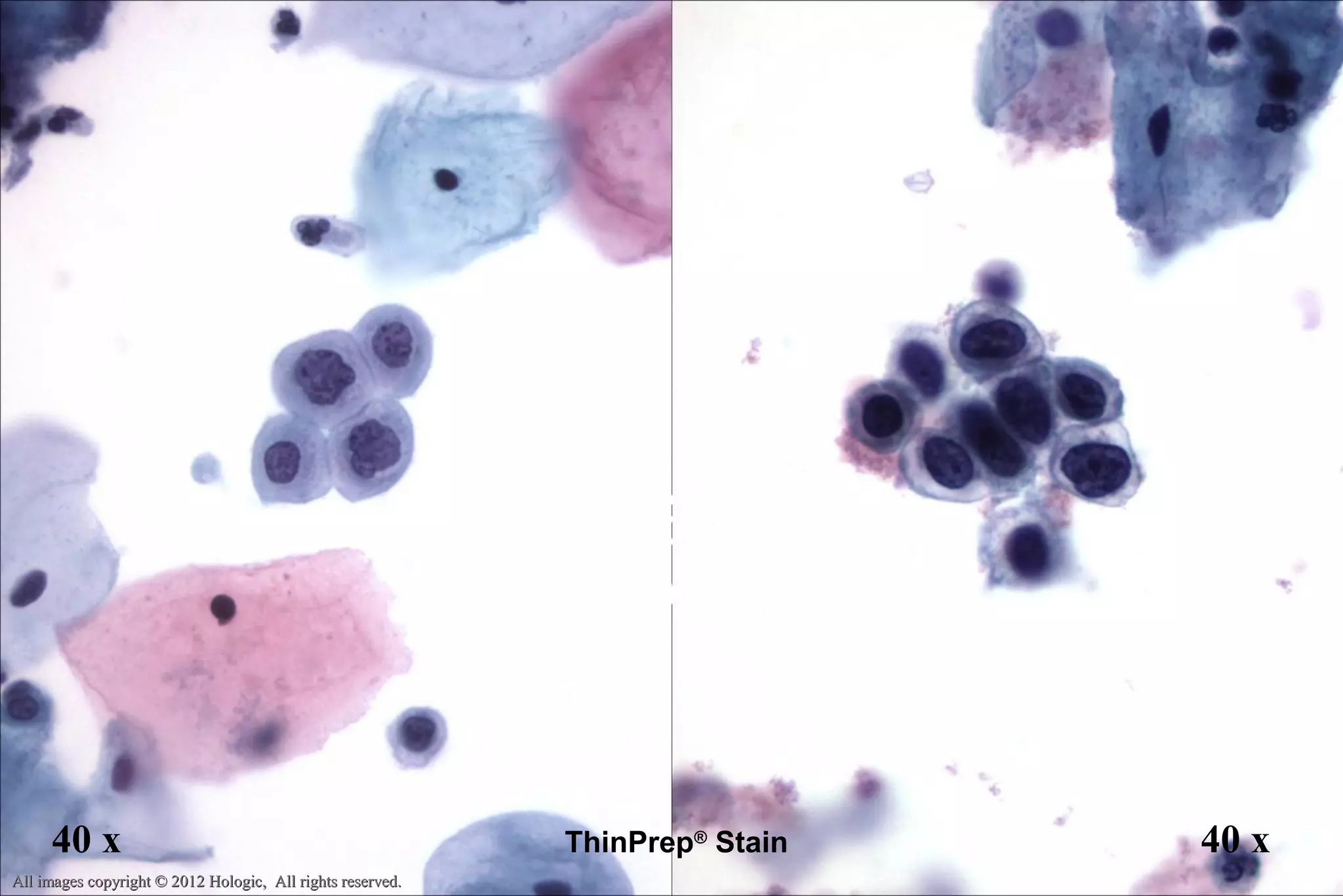 Thin prep morphology (Cervical cytology) | PPT