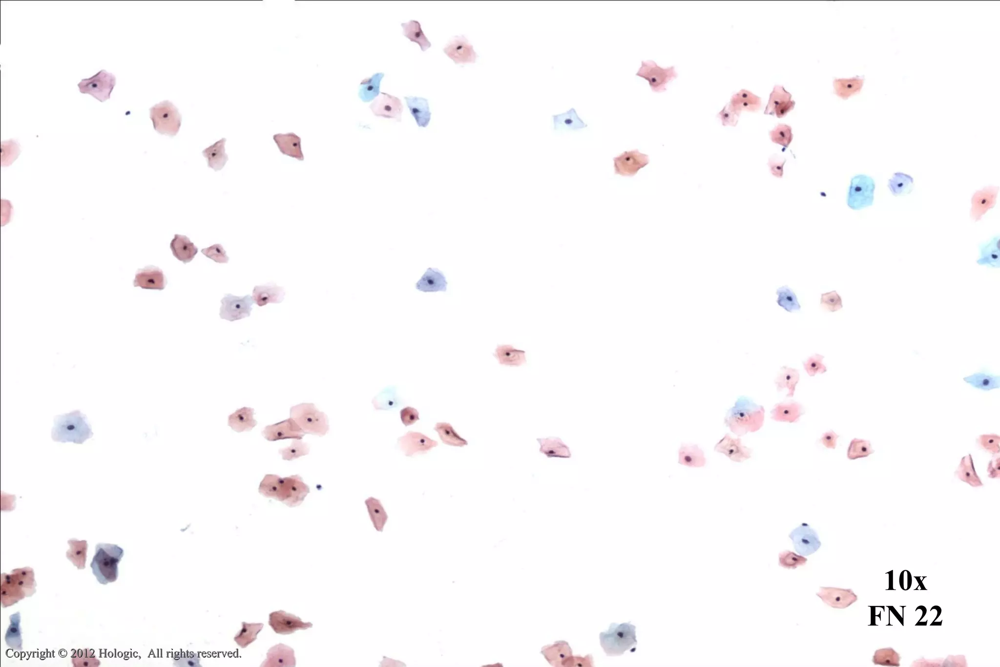 Thin prep morphology (Cervical cytology) | PPT