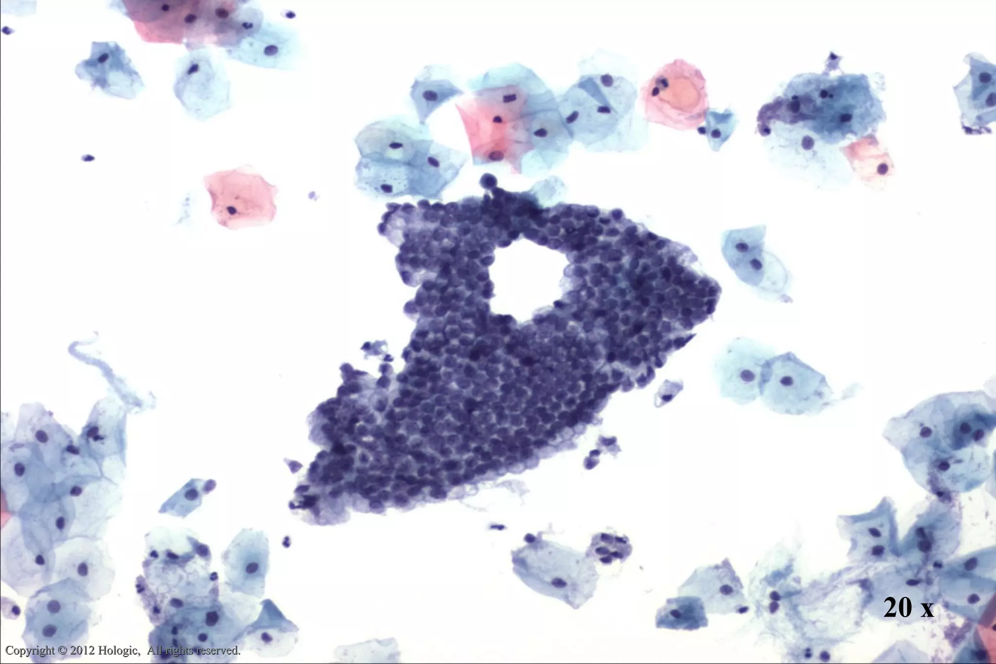 Thin prep morphology (Cervical cytology) | PPT