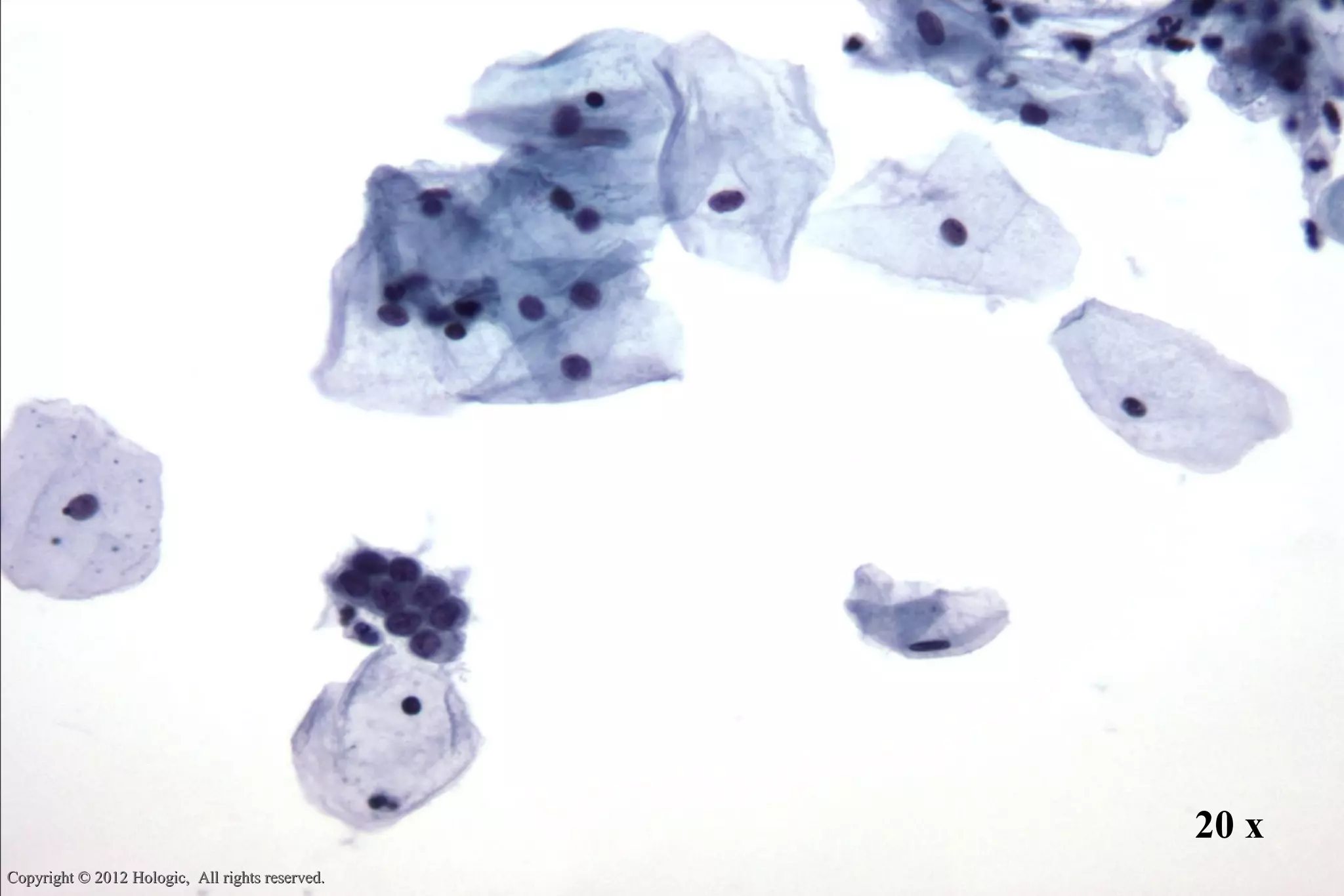 Thin prep morphology (Cervical cytology) | PPT