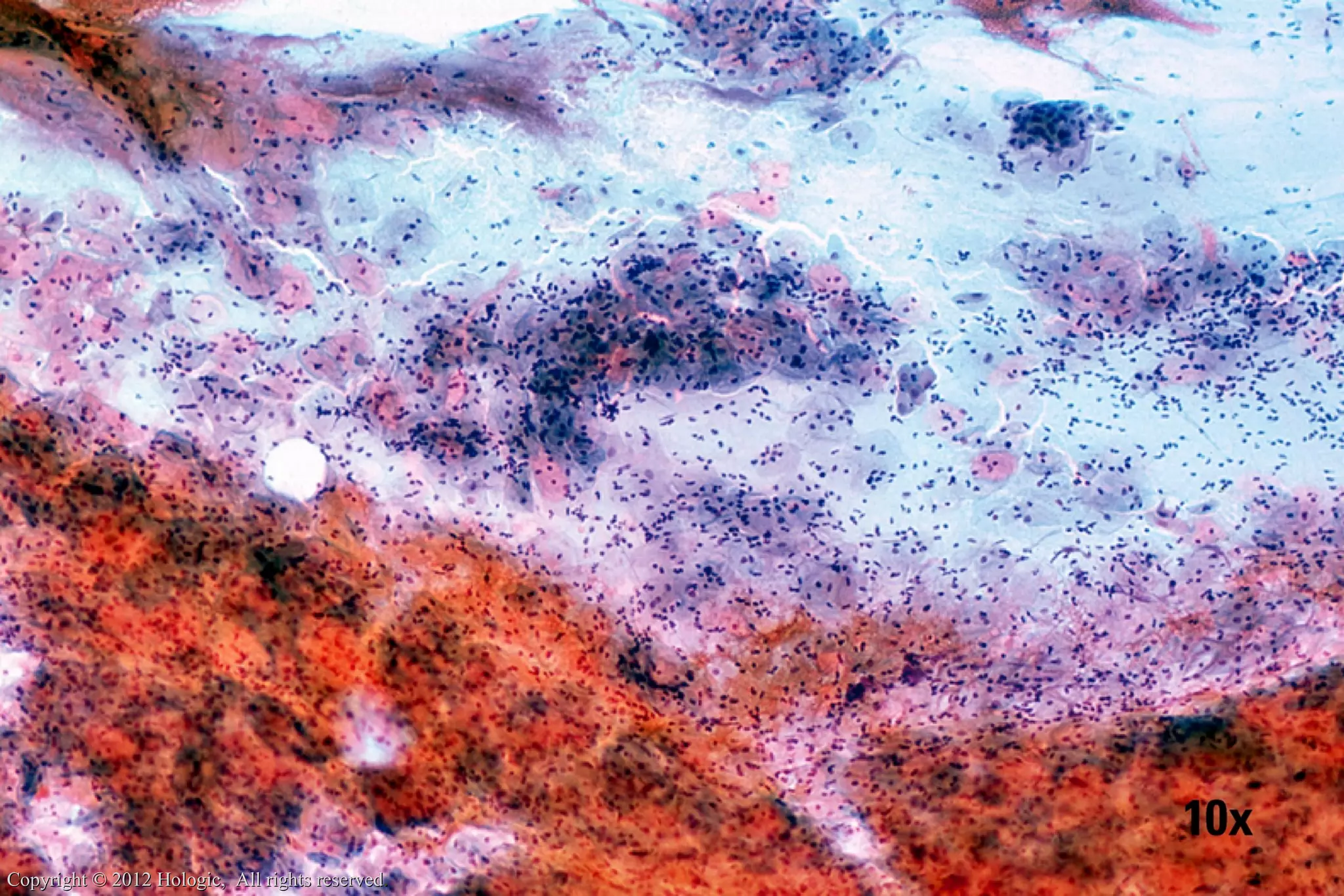 Thin prep morphology (Cervical cytology) | PPT