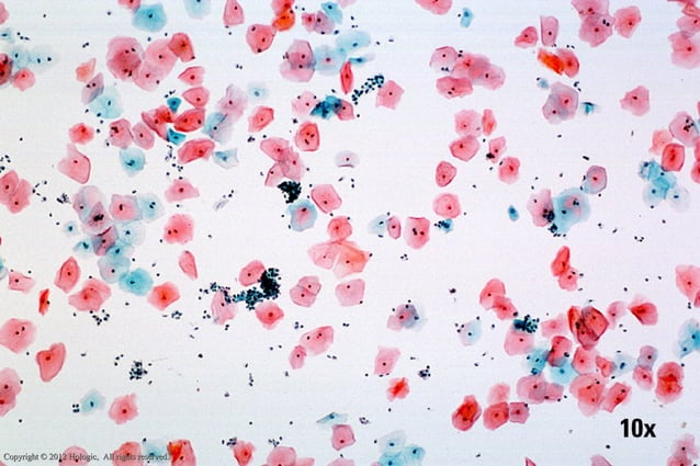 Thin prep morphology (Cervical cytology) | PPT