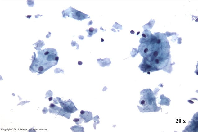 Thin prep morphology (Cervical cytology) | PPT