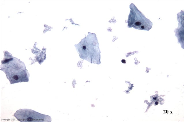 Thin prep morphology (Cervical cytology) | PPT