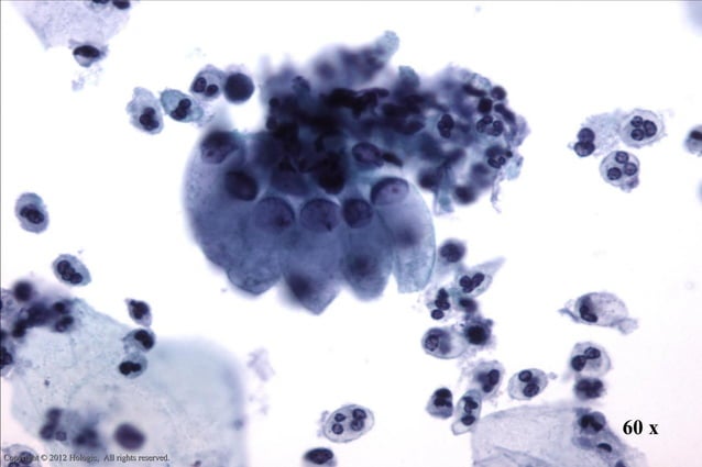 Thin prep morphology (Cervical cytology) | PPT