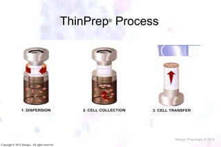 Thin prep morphology (Cervical cytology) | PPT