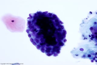 Thin prep morphology (Cervical cytology) | PPT