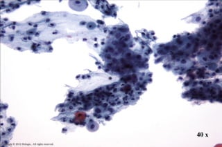 Thin prep morphology (Cervical cytology) | PPT