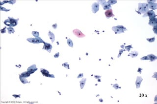Thin prep morphology (Cervical cytology) | PPT