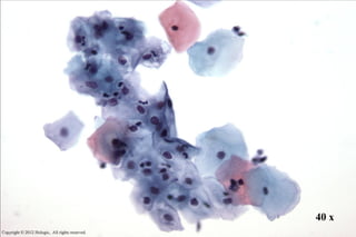 Thin prep morphology (Cervical cytology) | PPT
