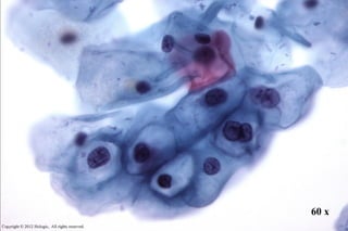 Thin prep morphology (Cervical cytology) | PPT