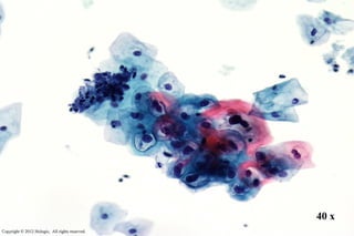 Thin prep morphology (Cervical cytology) | PPT