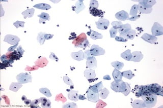 Thin prep morphology (Cervical cytology) | PPT