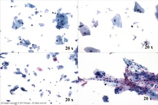 Thin prep morphology (Cervical cytology) | PPT