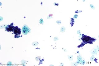 Thin prep morphology (Cervical cytology) | PPT