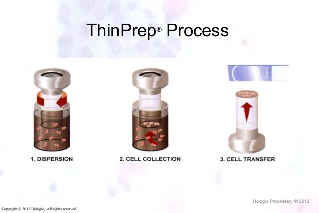 Thin prep morphology (Cervical cytology)