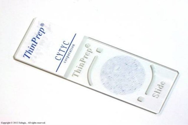 Thin prep morphology (Cervical cytology)