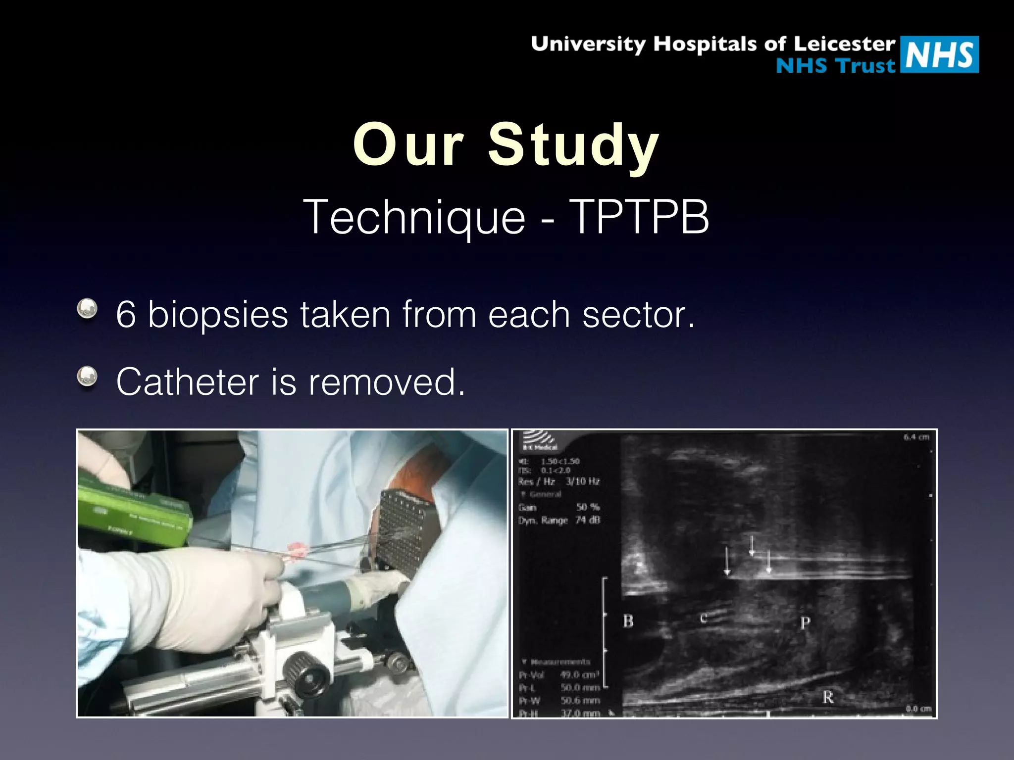 Transperineal Template Prostate Biopses Ppt Cancer Diseases And Conditions