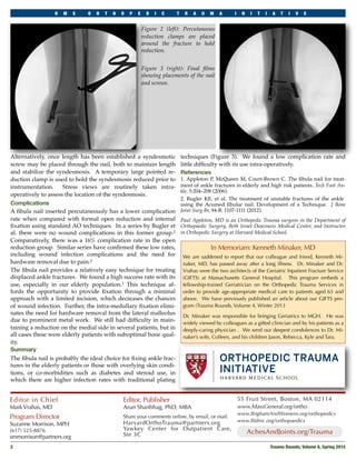 Fibula Nail for Unstable Ankle Fractures | PDF