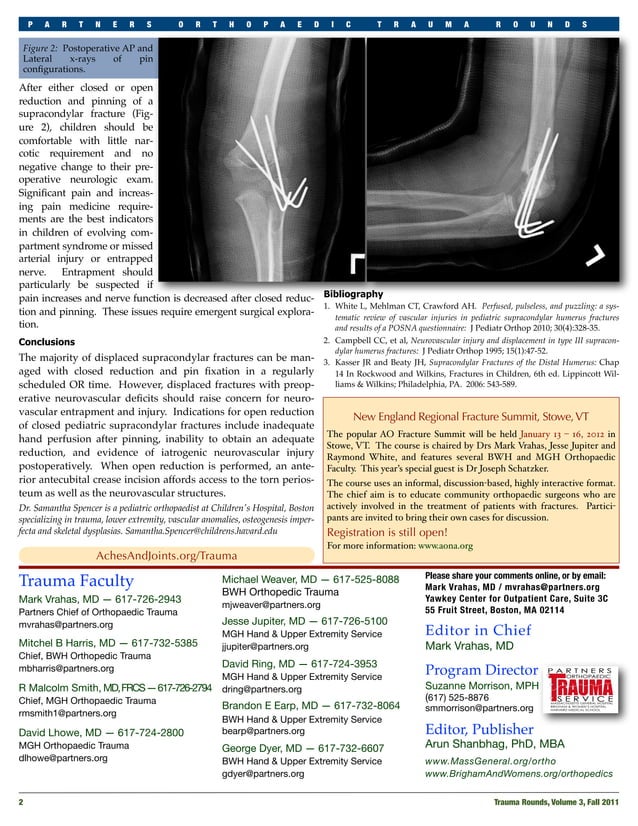 Pediatric Supracondylar Fractures | PDF