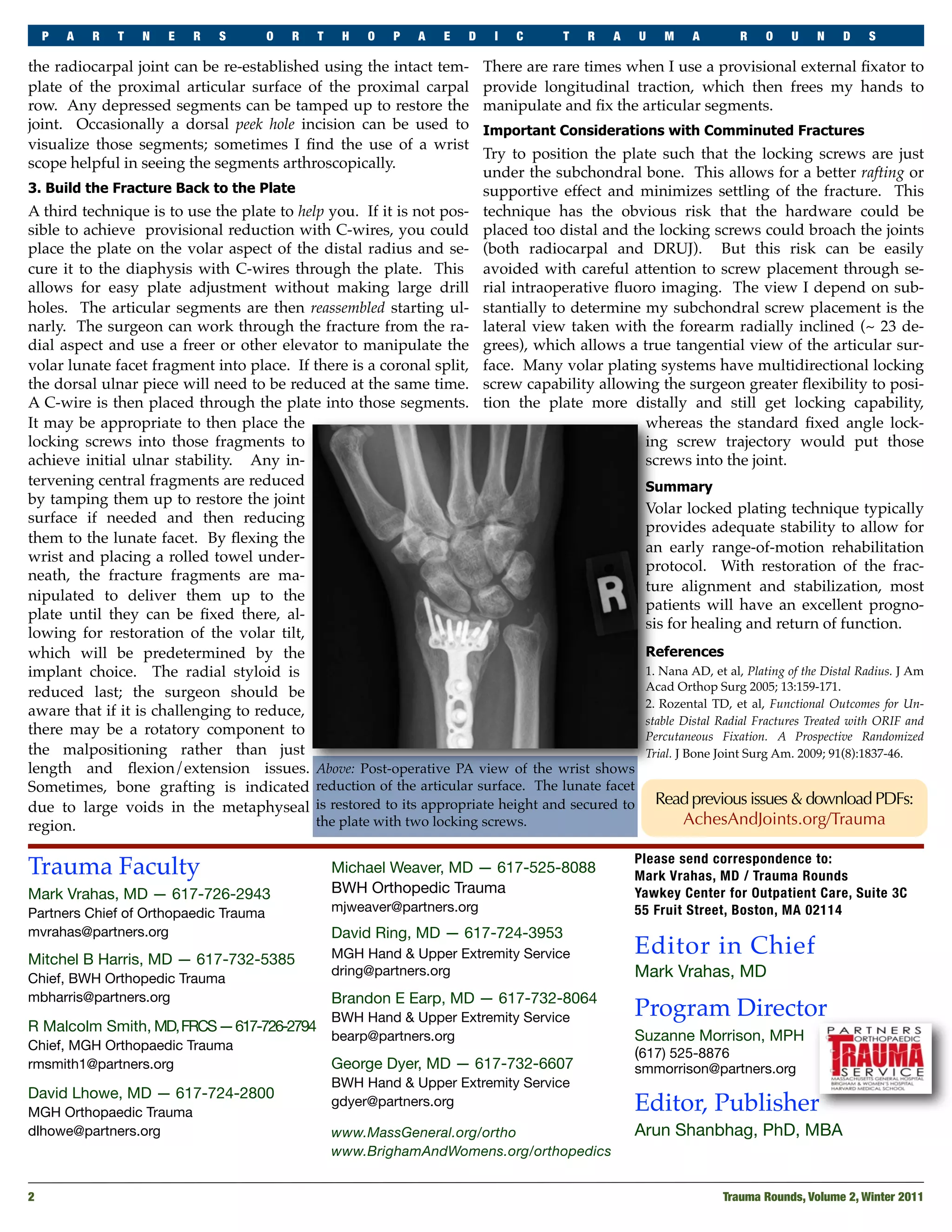 Intra-articular Distal Radius Fractures | PDF