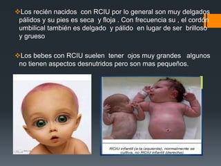 retardo del crecimiento uterrino | PPTX