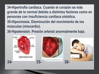 terminologia del sistema cardiaco | PPT