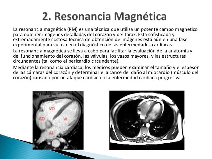 radiologia de corazón