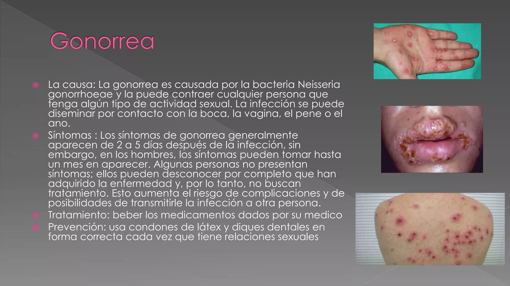 Sexualidad Metodos Anticonceptivos Y Enfermedades De Transmision