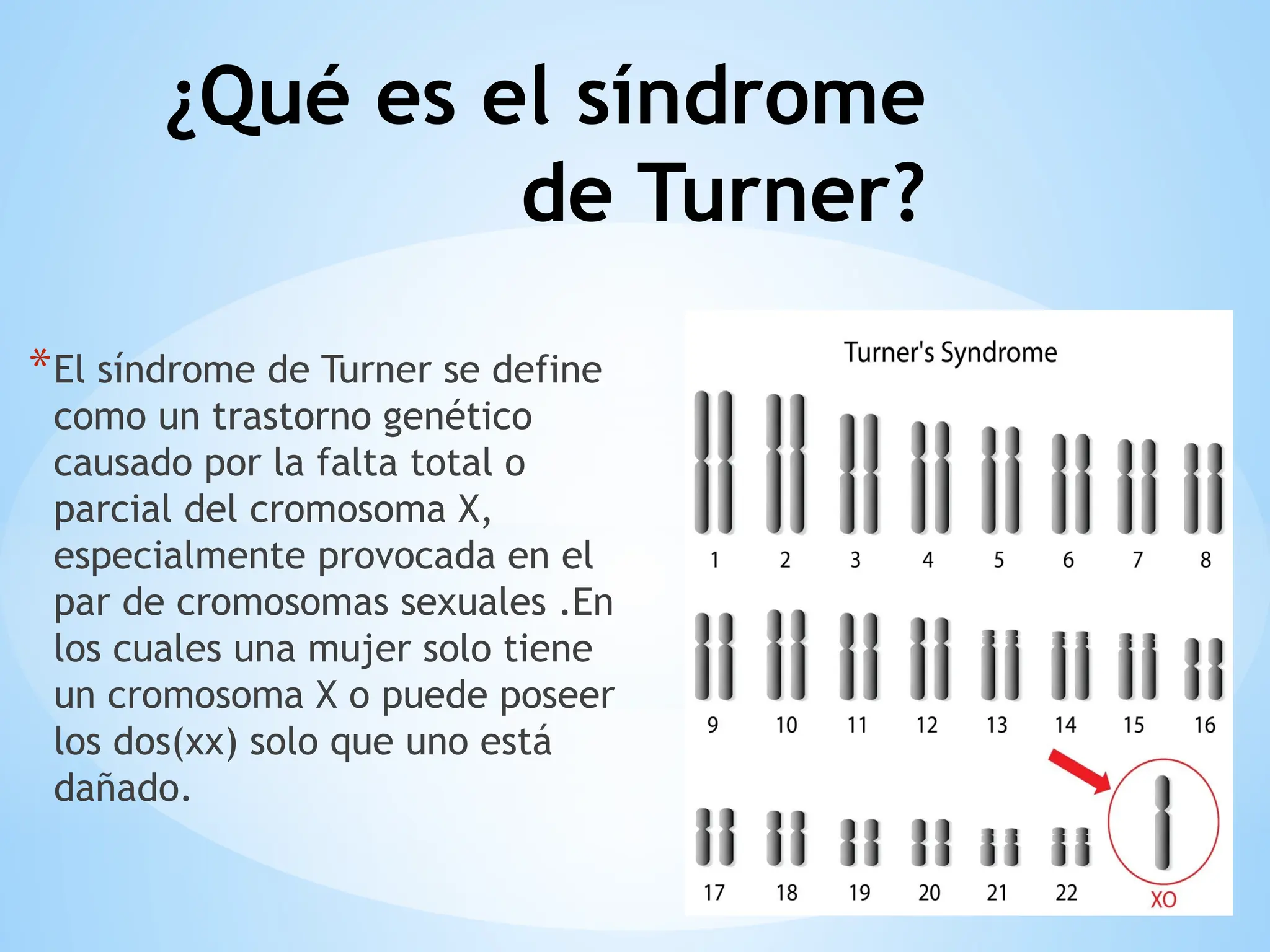 Trabajo_de_biologia_sindrome_de_turner-49788060.pptx