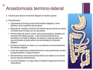 Trabajo de cirugía de intestino delgado | PPTX