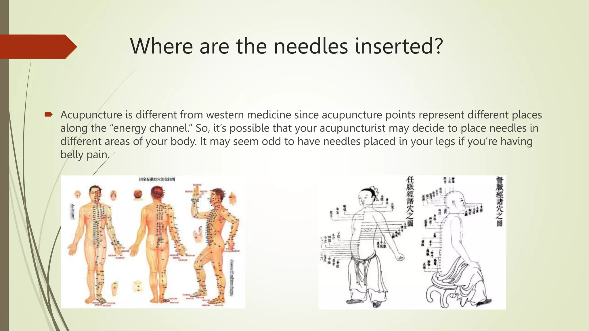 acupunture | PPTX | Holistic Health | Alternative Medicine