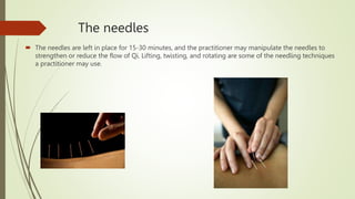 acupunture | PPTX