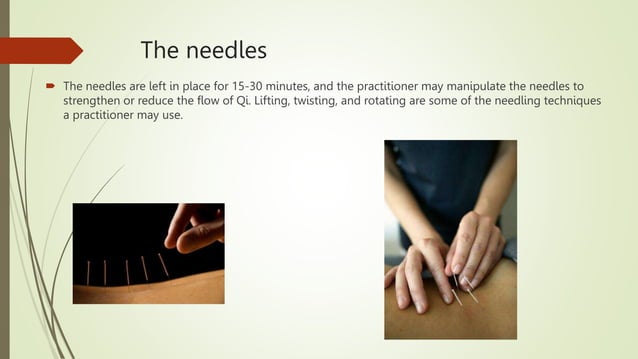 acupunture | PPT