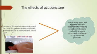 acupunture | PPTX | Holistic Health | Alternative Medicine