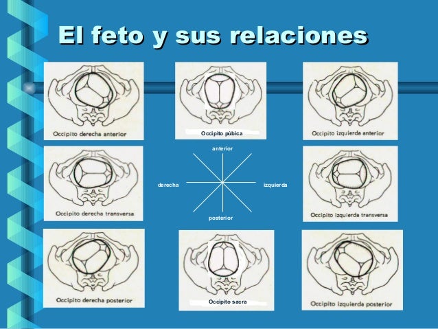 Trabajo de parto