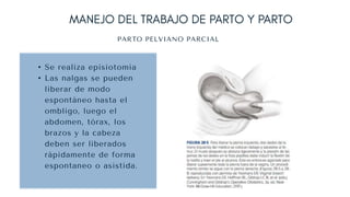atencion del parto pelviano en hospitales | PPTX