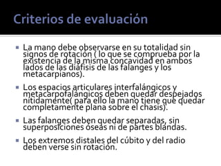 Radiología de Miembro Superior | PPTX