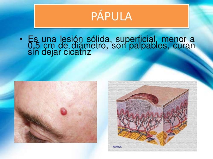 Trabajo medi seminario lesiones