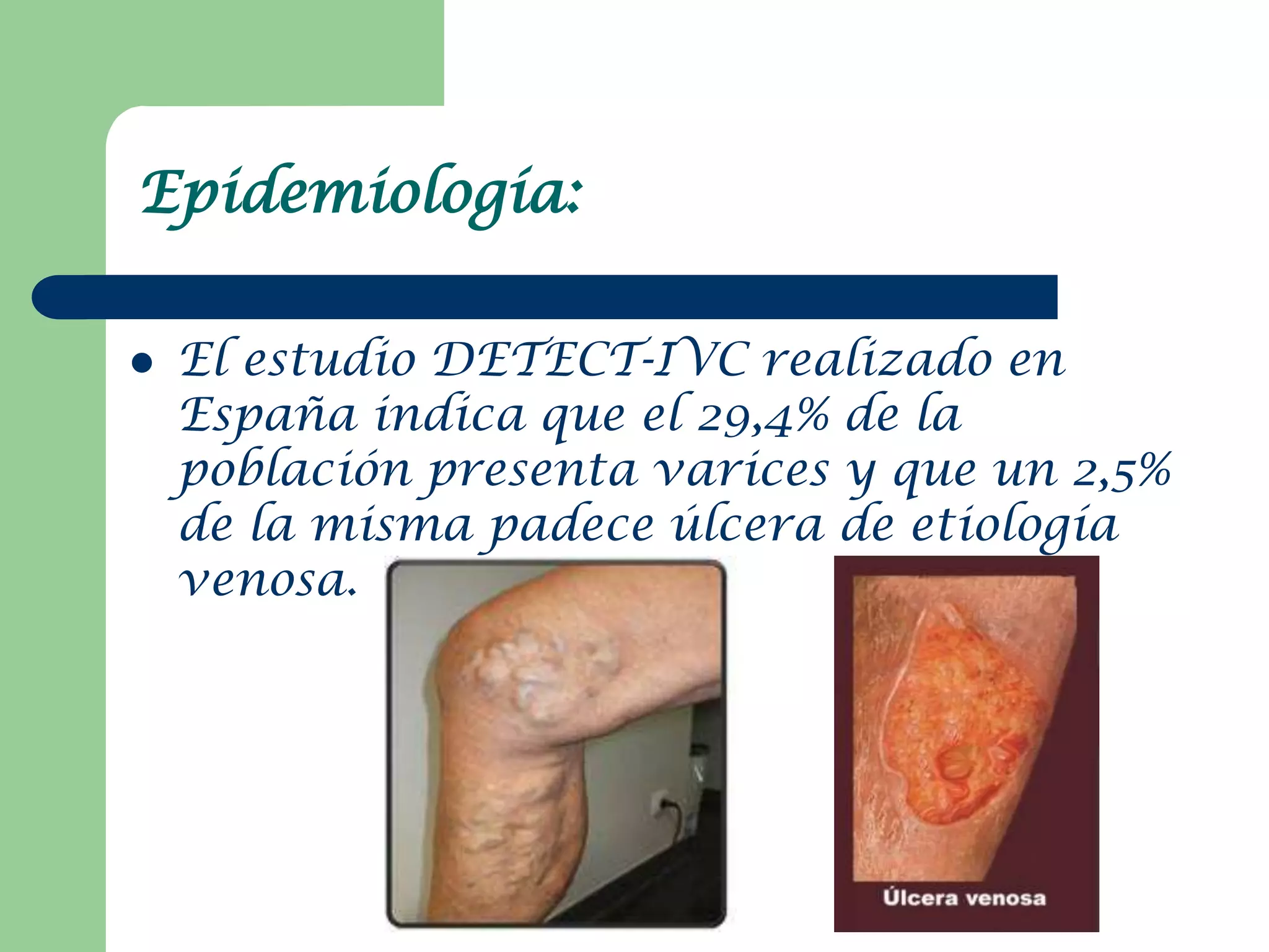 Insuficiencia venosa crónica | PPT