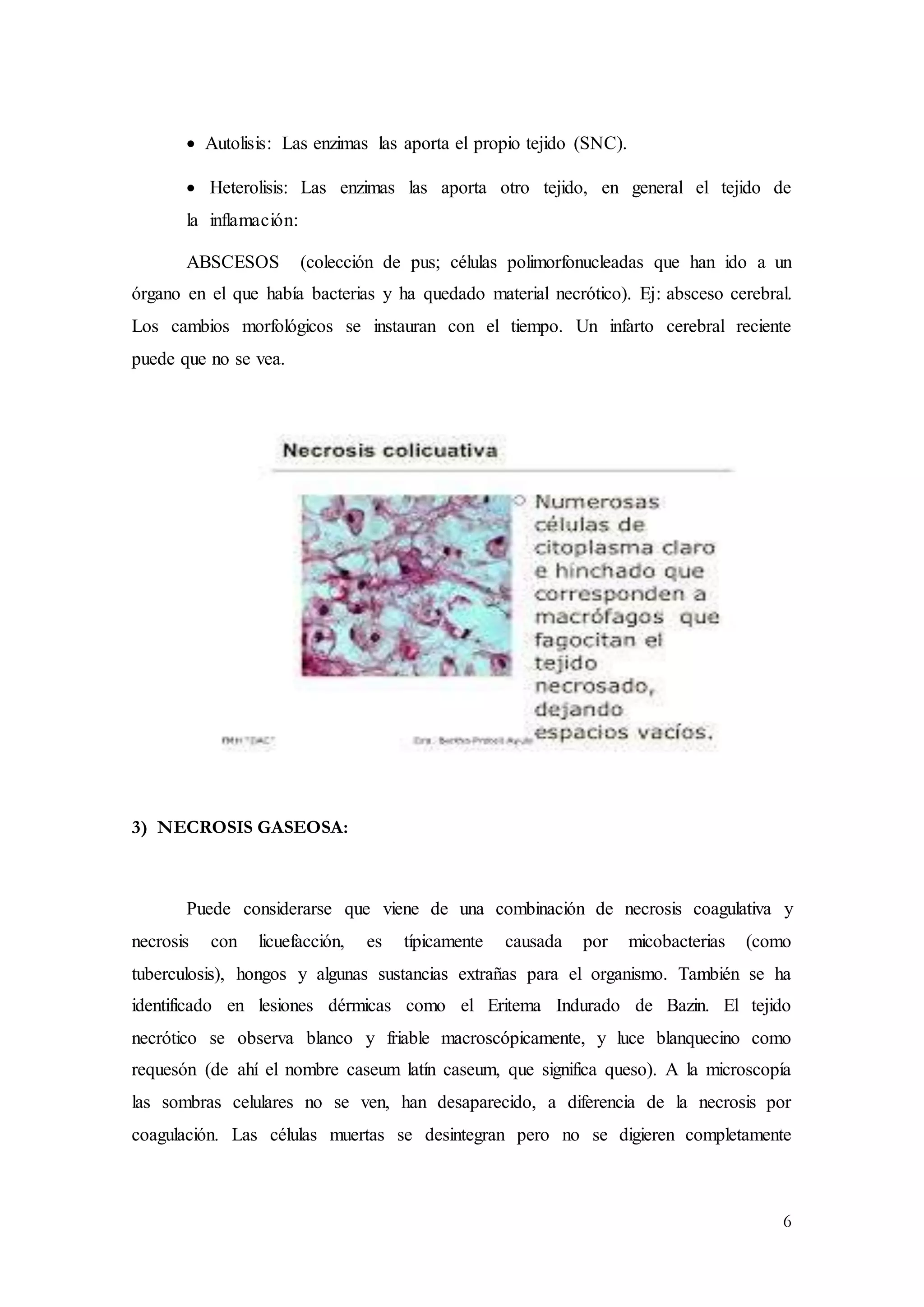 Trabalho necrosis polini e naty word | DOCX