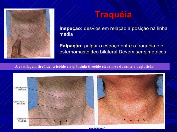 Semiologia do Pescoço
