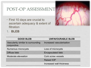 Trabeculectomy | PPTX