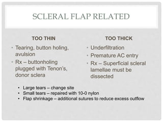 Trabeculectomy | PPTX