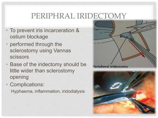 Trabeculectomy Diagram