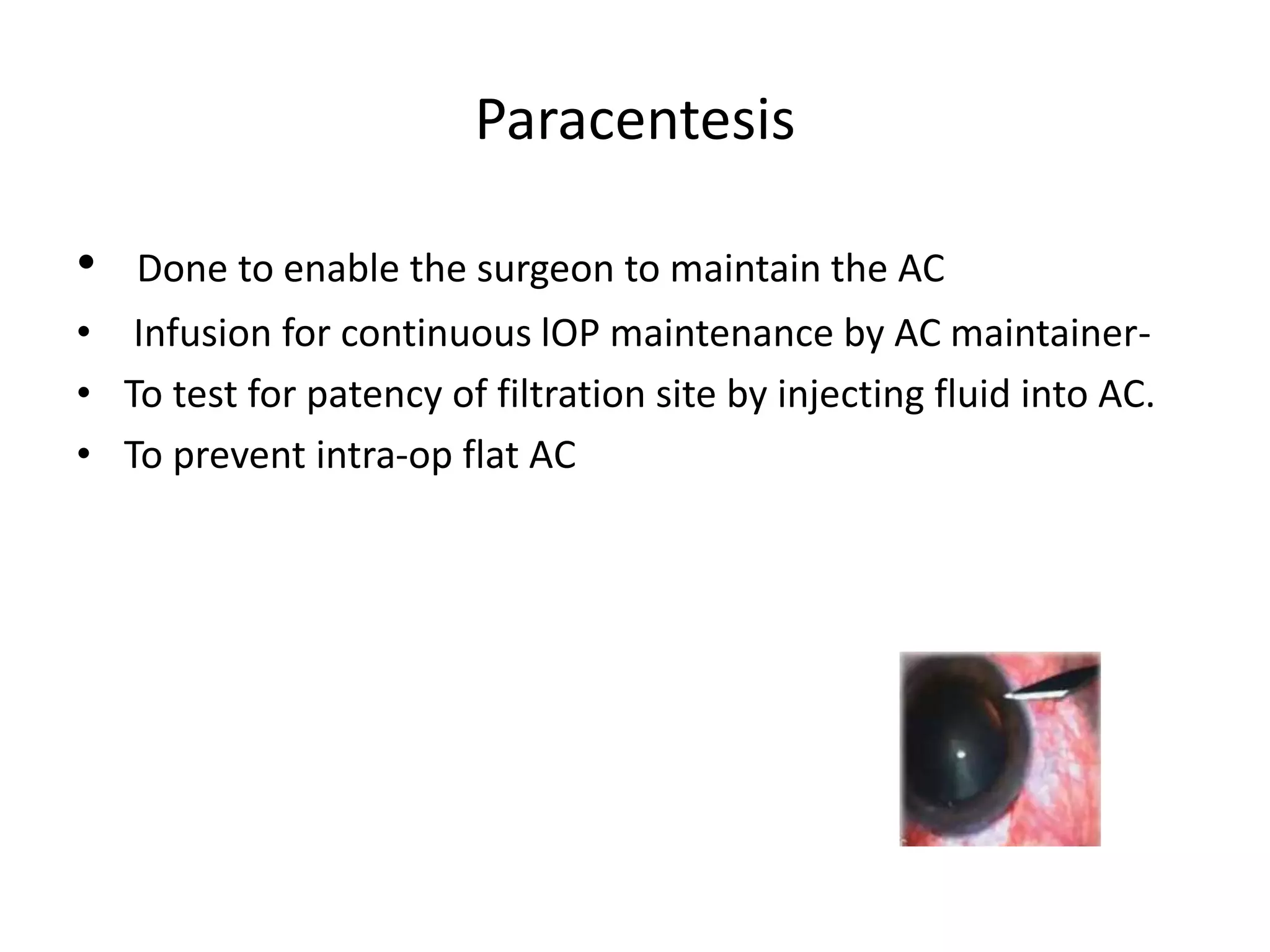 Trabeculectomy.pptx