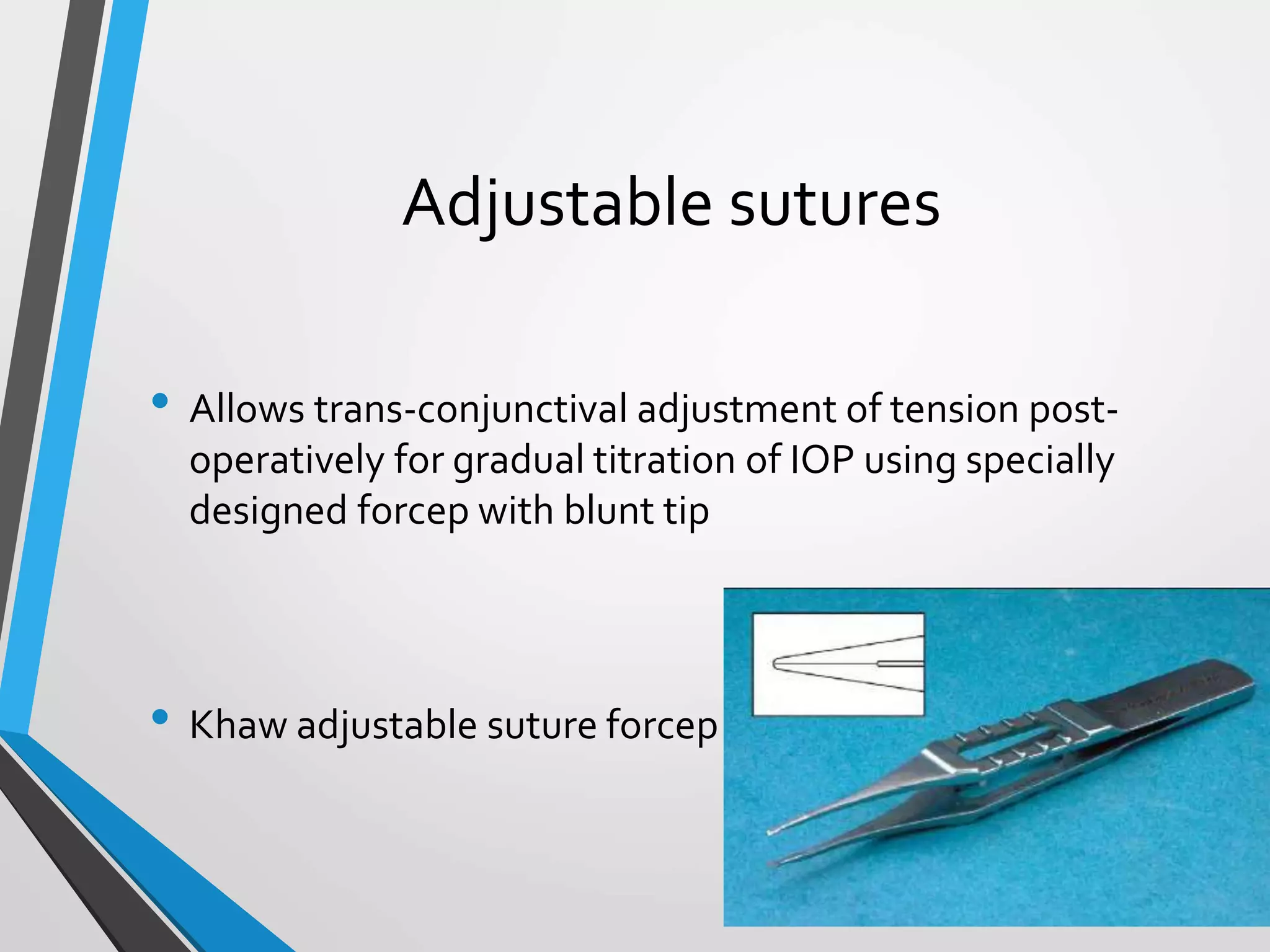 Trabeculectomy, trabeculotomy, goniotomy and their complications | PPTX