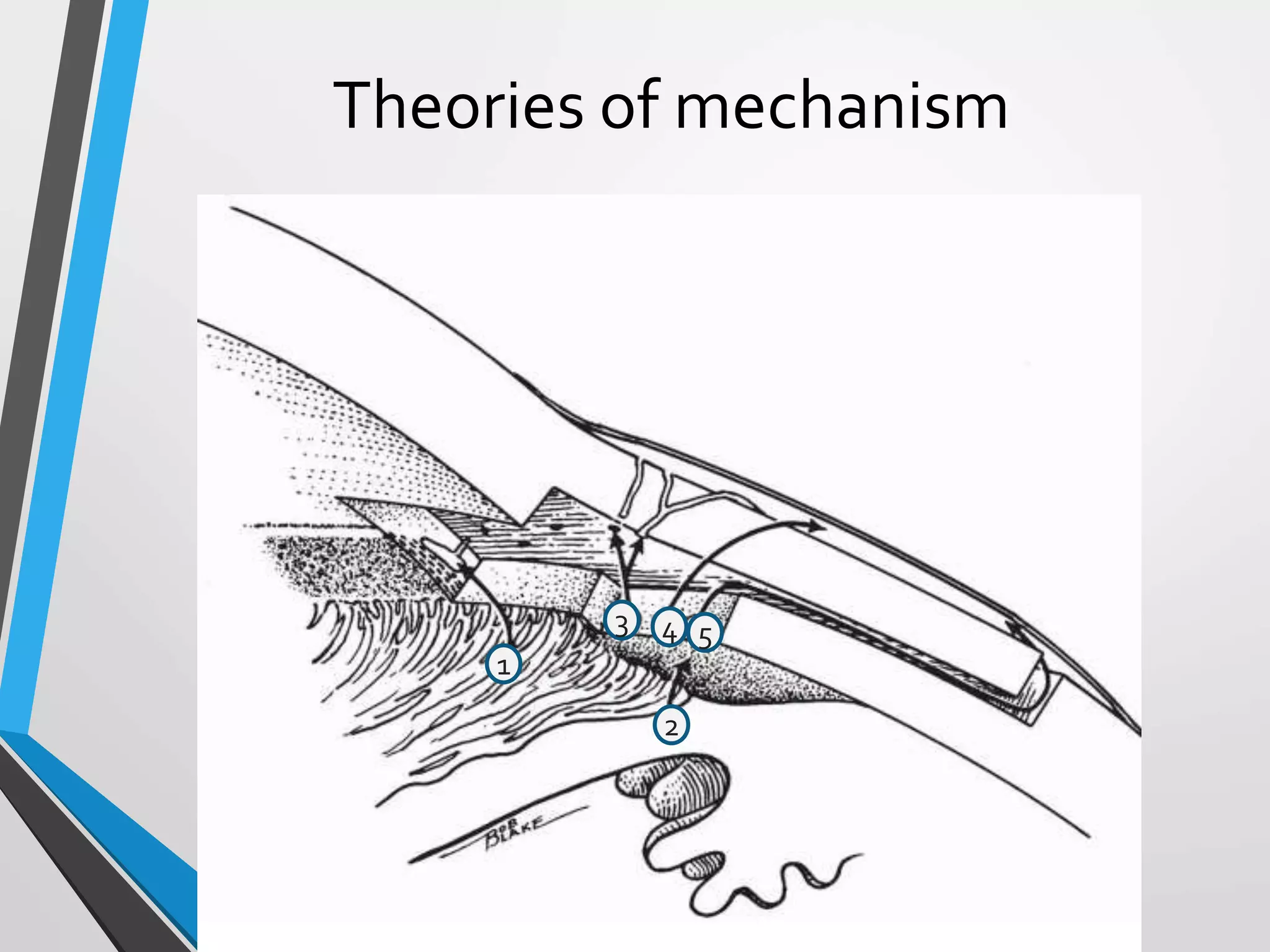 Trabeculectomy, trabeculotomy, goniotomy and their complications | PPTX