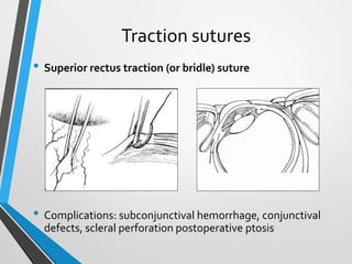Trabeculectomy, trabeculotomy, goniotomy and their complications | PPTX