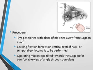 Trabeculectomy, trabeculotomy, goniotomy and their complications | PPTX